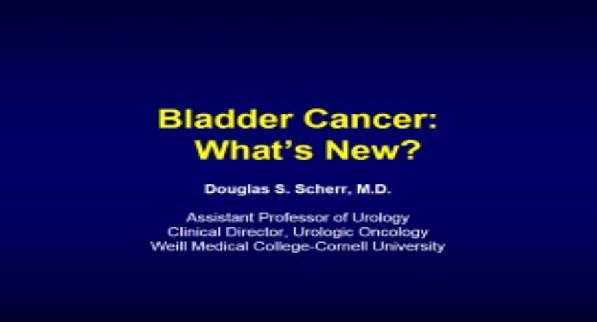 Free Download Management of Superficial Bladder Cancer PowerPoint ...