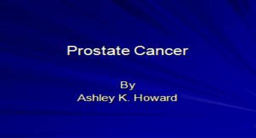 Free Download Prostate Cancer by Department of Radiology PowerPoint ...
