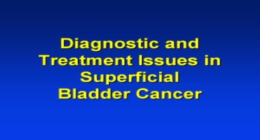 Free Download Bladder Cancer Incidence by Stage PowerPoint Presentation ...