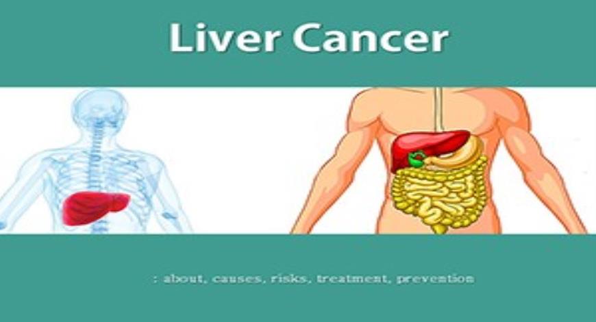 Free Download Liver Cancer Powerpoint (Ppt) Presentation | SlidesFinder