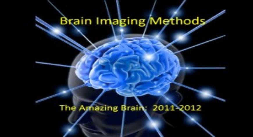 Free Download Brain Imaging Methods PowerPoint Presentation Slides