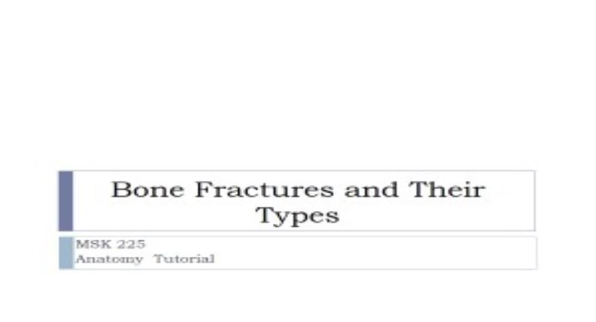 Free Download Bone Fractures and Their Types PowerPoint Presentation Slides