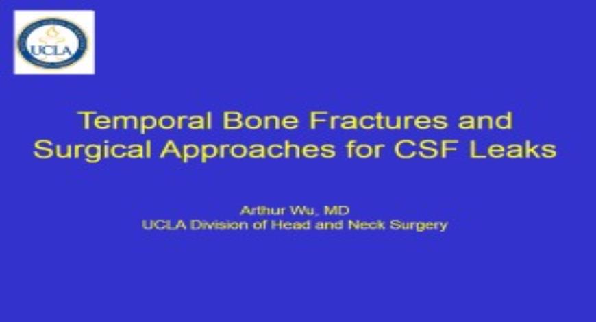 Free Download Temporal Bone Fractures PowerPoint Presentation Slides