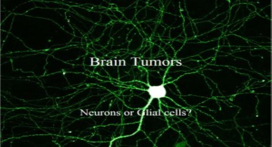 Free Download Brain Tumors PowerPoint Presentation Slides