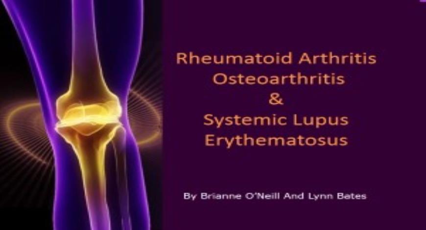 Free Download Introduction Rheumatoid Arthritis PowerPoint Presentation ...