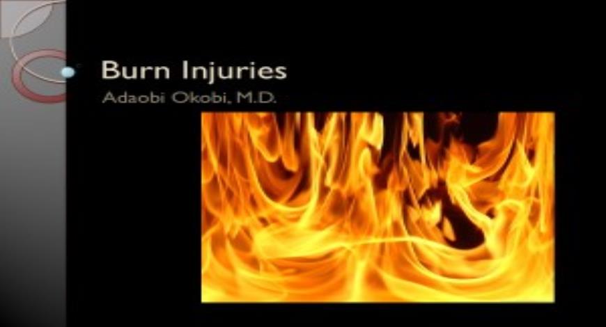Free Download Human Burn Injuries PowerPoint Presentation Slides
