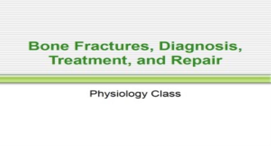 Free Download Bone Fractures Diagnosis Treatment and Repair PowerPoint ...