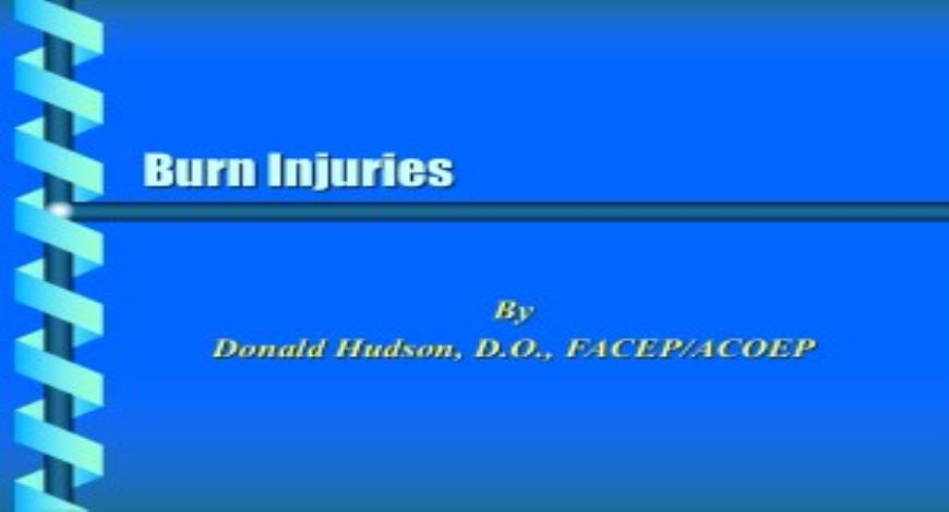 Free Download Burn Injuries PowerPoint Presentation Slides
