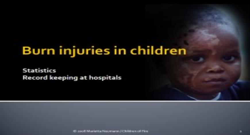 Free Download Burn injuries in children PowerPoint Presentation Slides