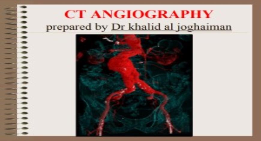 Free Download About CT ANGIOGRAPHY PowerPoint Presentation Slides