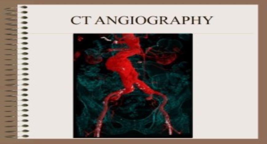 Free Download CT ANGIOGRAPHY PowerPoint Presentation Slides