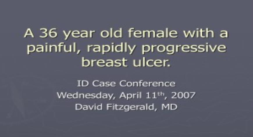 Free Download Breast abscess PowerPoint Presentation Slides