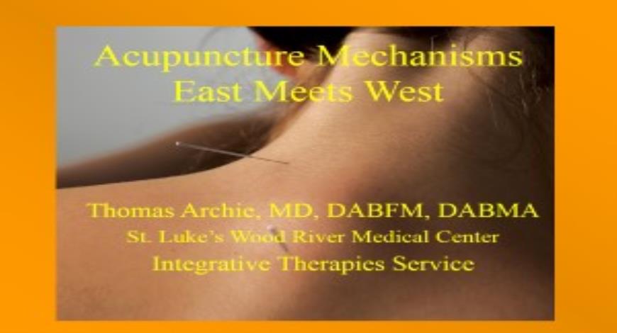 Free Download East Meets West Acupuncture Mechanisms PowerPoint Presentation Slides
