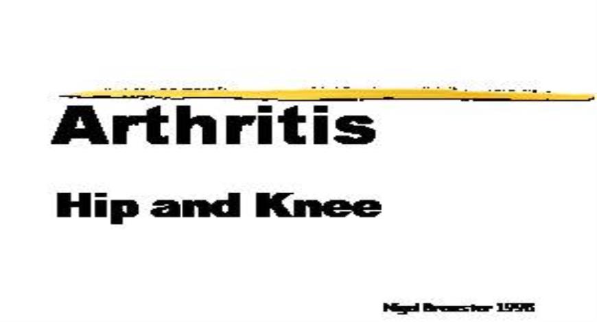 Free Download Arthritis Powerpoint Presentation Slides