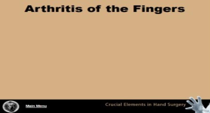 Free Download Arthritis Of The Finger Powerpoint Presentation Slides