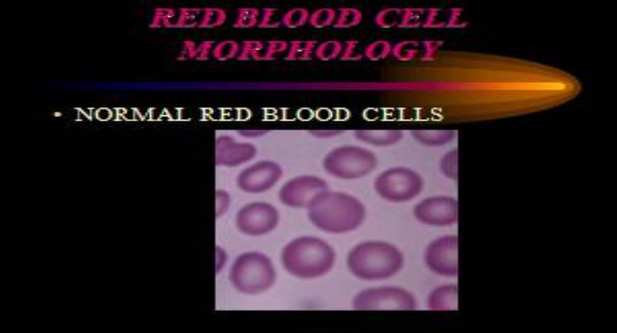 Free Download RED BLOOD CELL MORPHOLOGY PowerPoint Presentation ...
