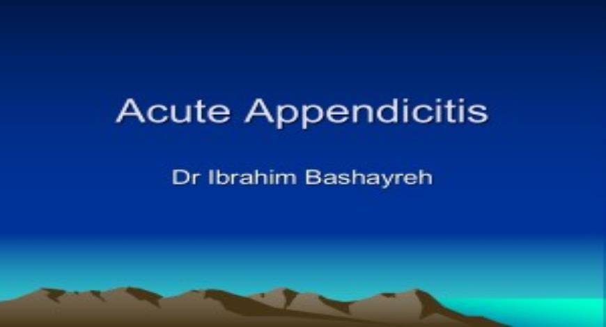 Free Download Acute Appendicitis University Jordan PowerPoint ...