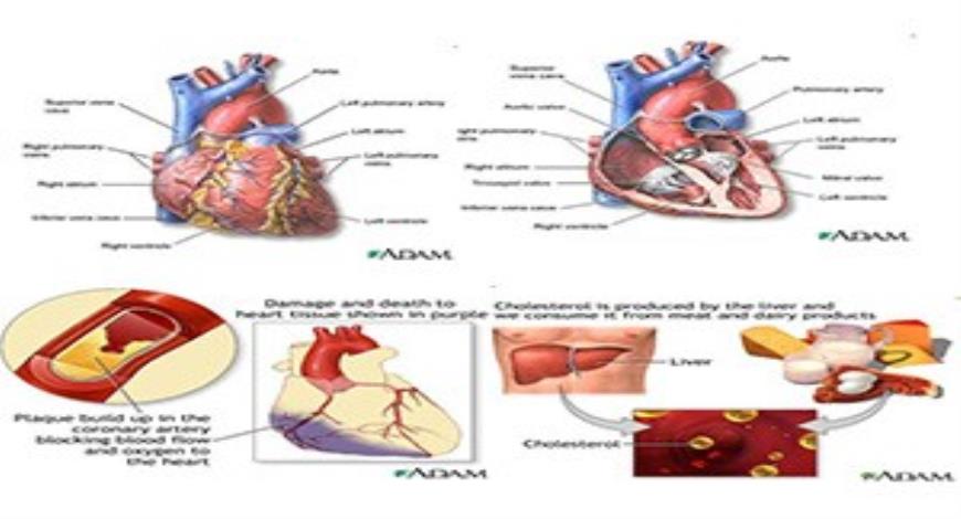 Free Download Coronary Heart Disease PowerPoint Presentation Slides ...