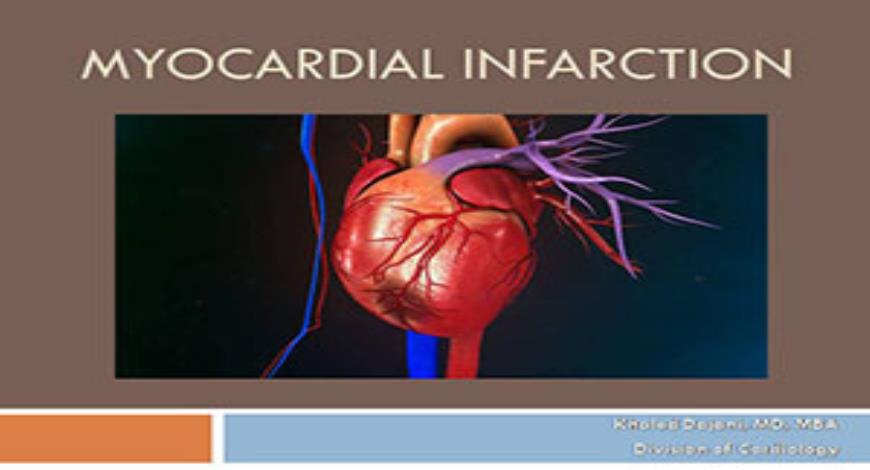 Free Download Myocardial Infarction Powerpoint Presentation