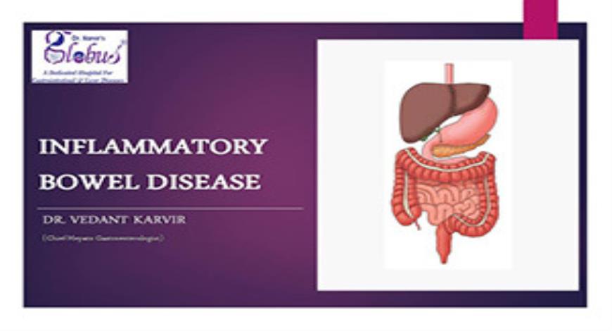 Free Download Inflammatory Bowel Disease PowerPoint Presentation | SlidesFinder.com